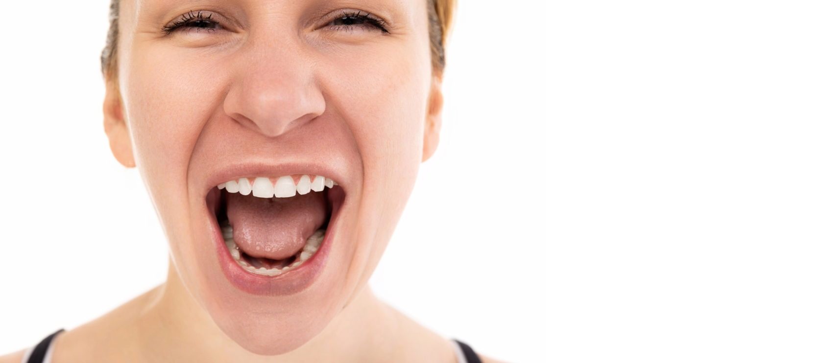 All On 4 Dental Implants | Cheadle Dental Practice